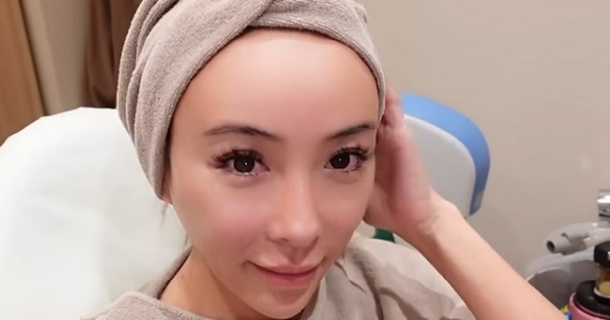 GENKING、整形であごのラインをシャープに 施術後の姿に「直後からもキュッてなっている気が」（1/2） | ねとらぼ